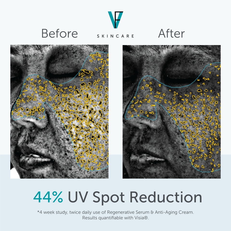 Anti-Aging Cream – FACTORFIVE Skincare